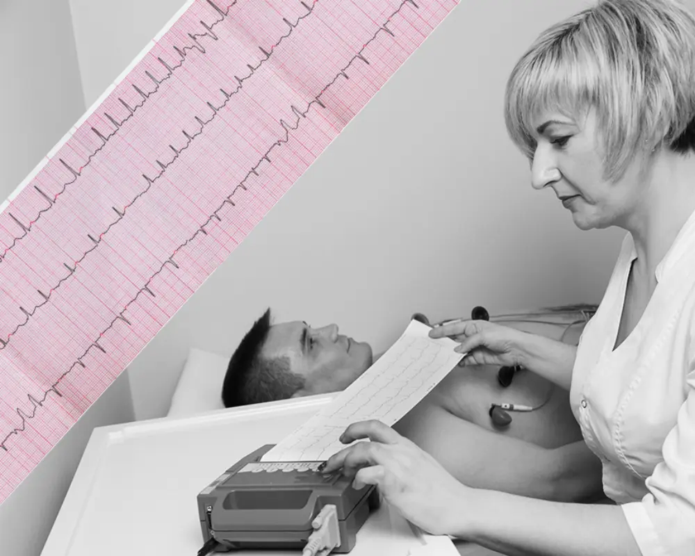 Atrial Fibrillation in General Practice – Screening & Care