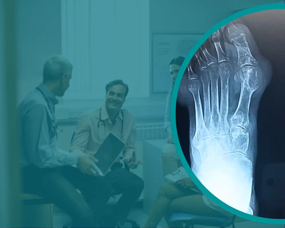 Gout Management Workshop Guide for Facilitators | Medcast