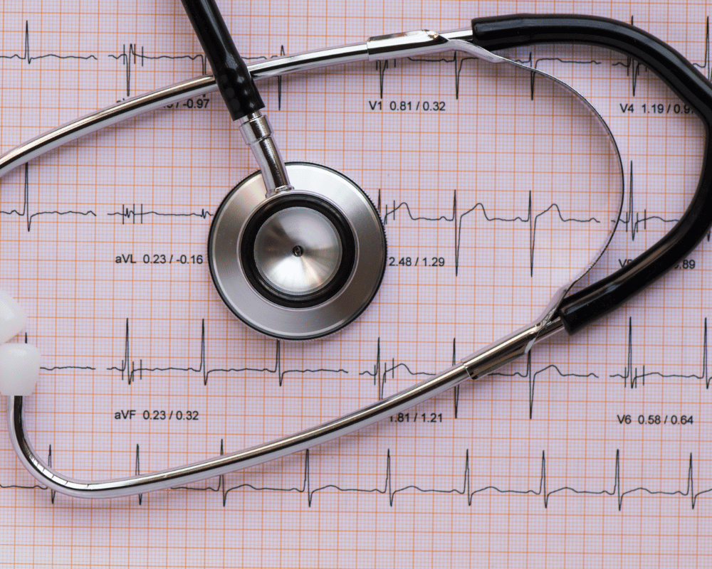 ECG Interpretation Course 2025 for Healthcare Professionals