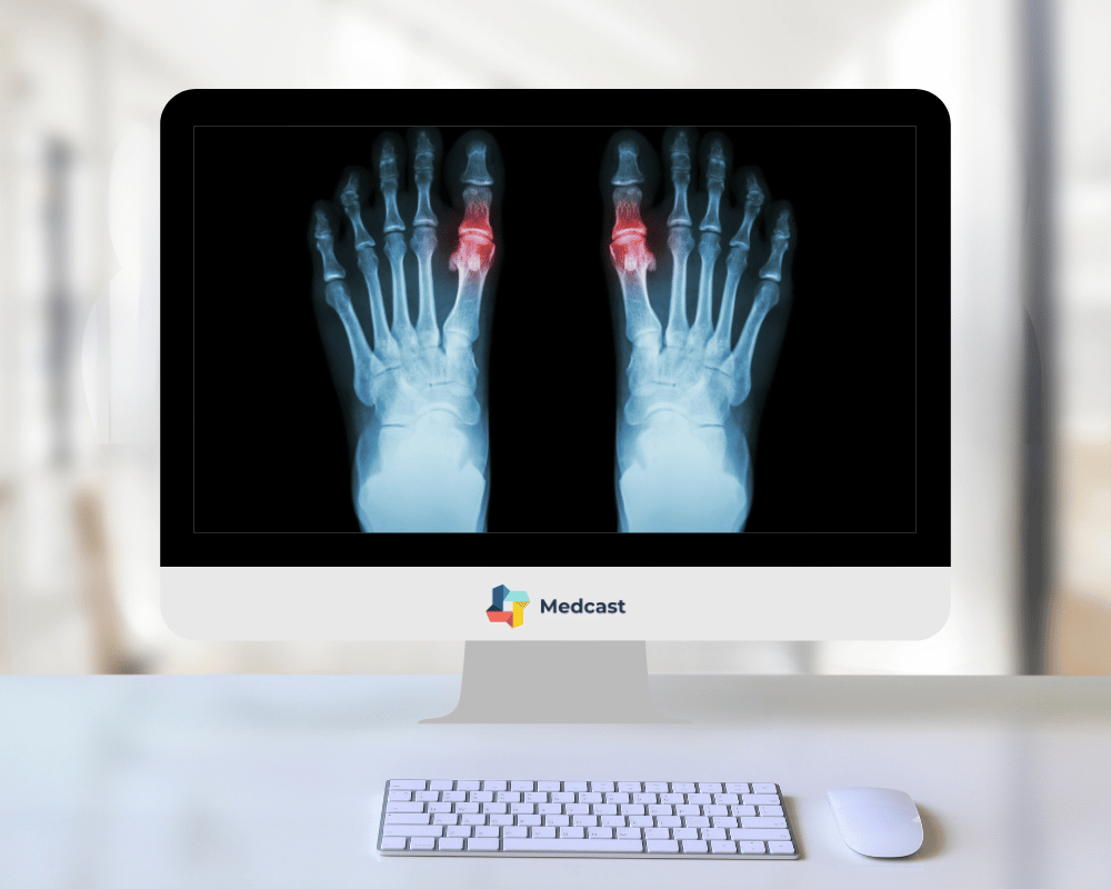 Diagnosing & Managing Gout: eLearning for GPs | Medcast