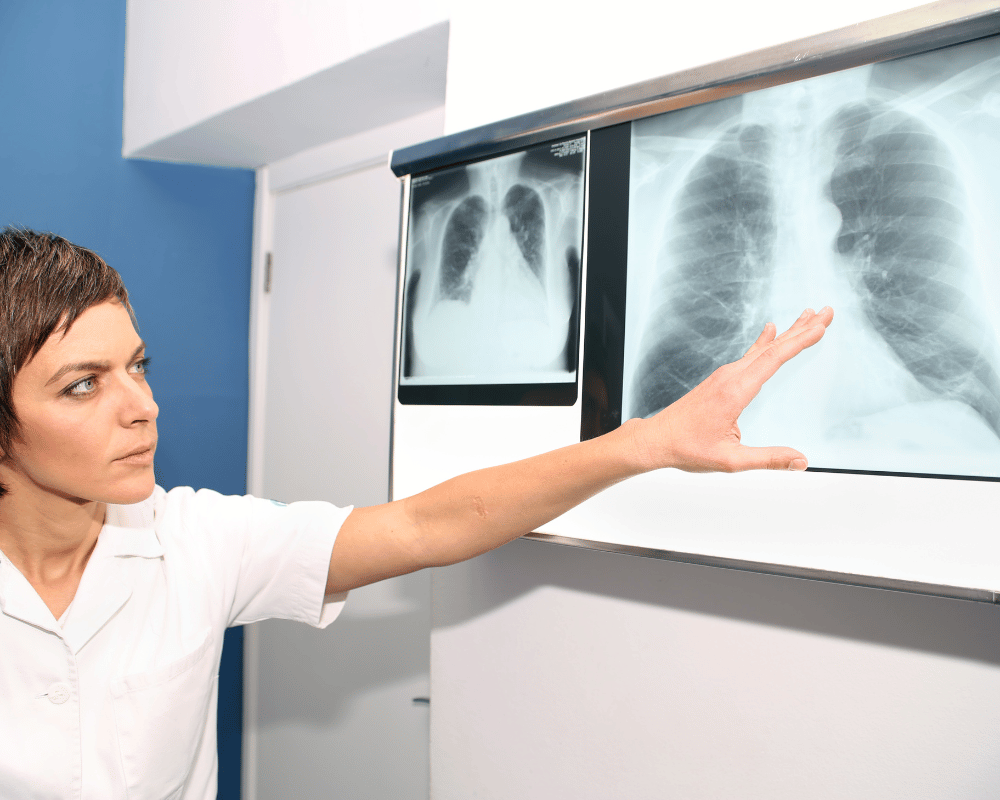 Advancements in heart failure and APO webinar | Medcast