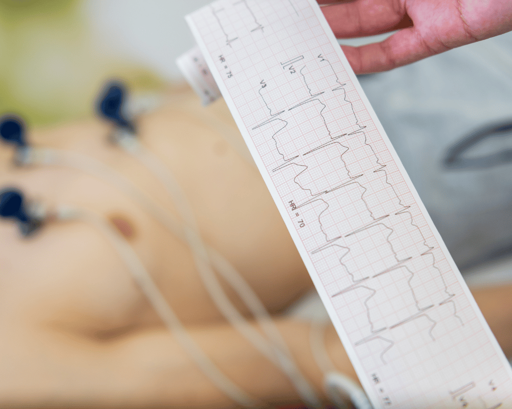 Rhythm Interpretation Refresher for Arrhythmia Management